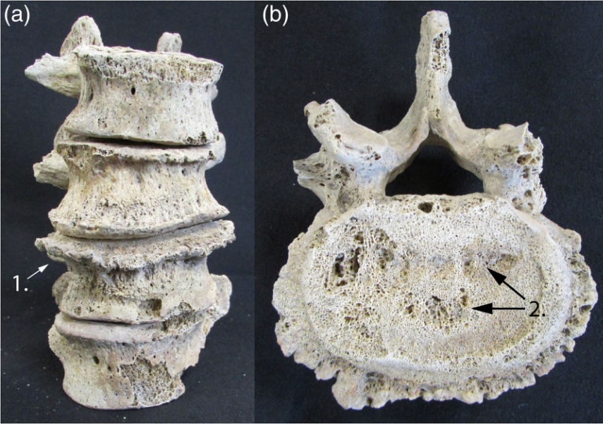 Evidence of human sacrifice in Dorset